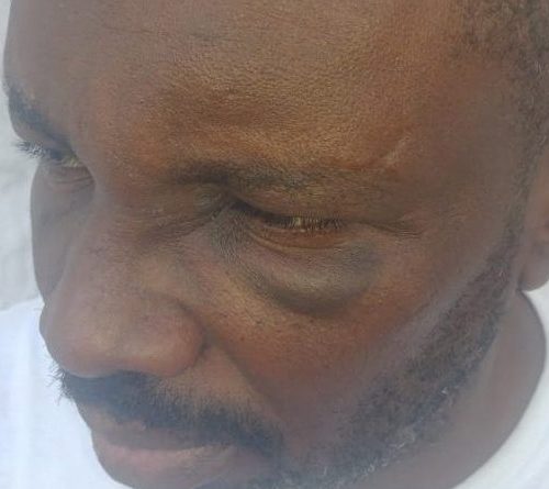 Former cop who was beaten in prison seeks justice for injuries he ...